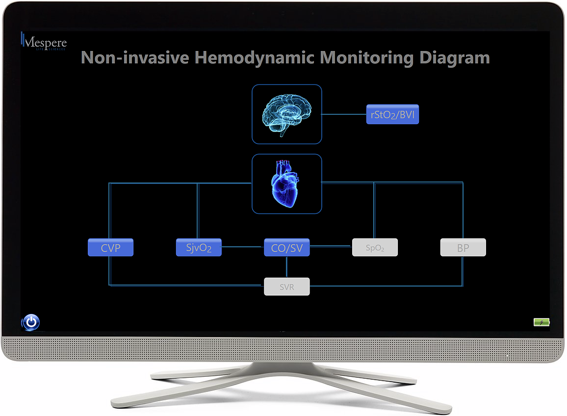 Mespere LifeSciences – Neurovisio