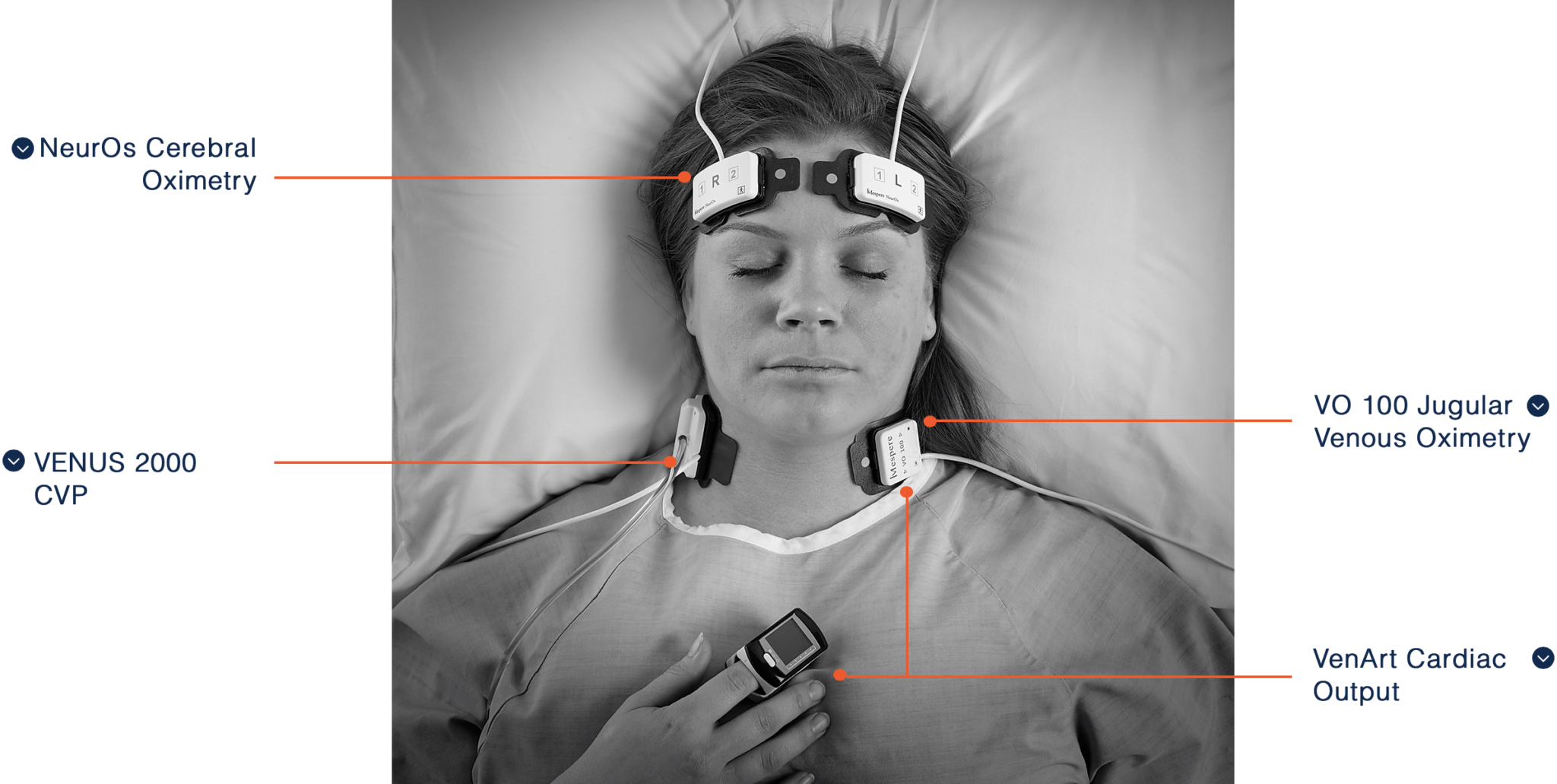 Mespere LifeSciences – Neurovisio