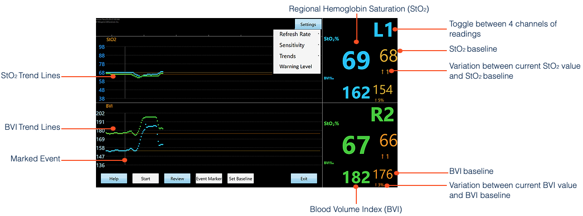 NeurOs Zerebrale Oximetrie – Neurovisio